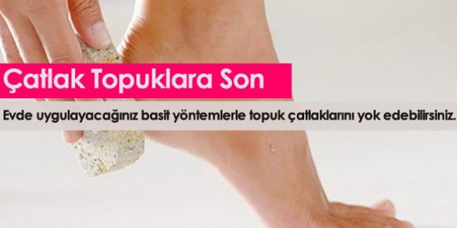 Topuk Çatlakları Neden Olur? Topuk Çatlağının Tedavisi Nedir? 2025 ...